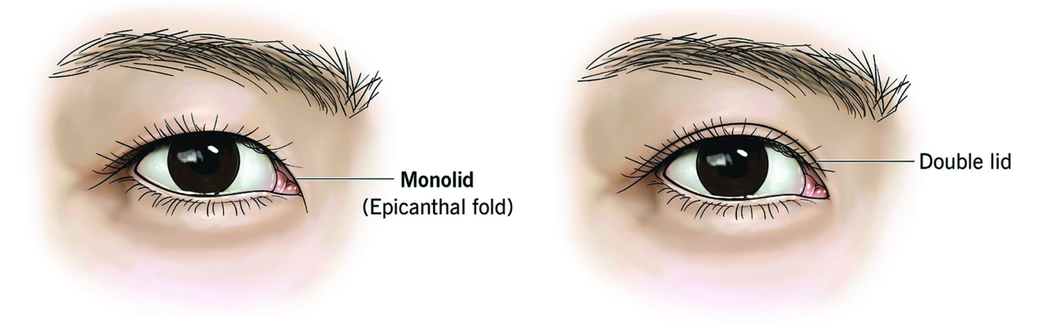 Cosmetic Treatments - Fraser Valley Cataract & Laser